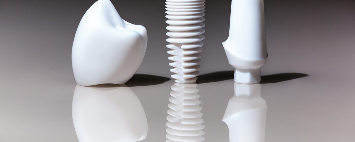 5 Differences Between Titanium vs Ceramic Implants | Central Valley ...